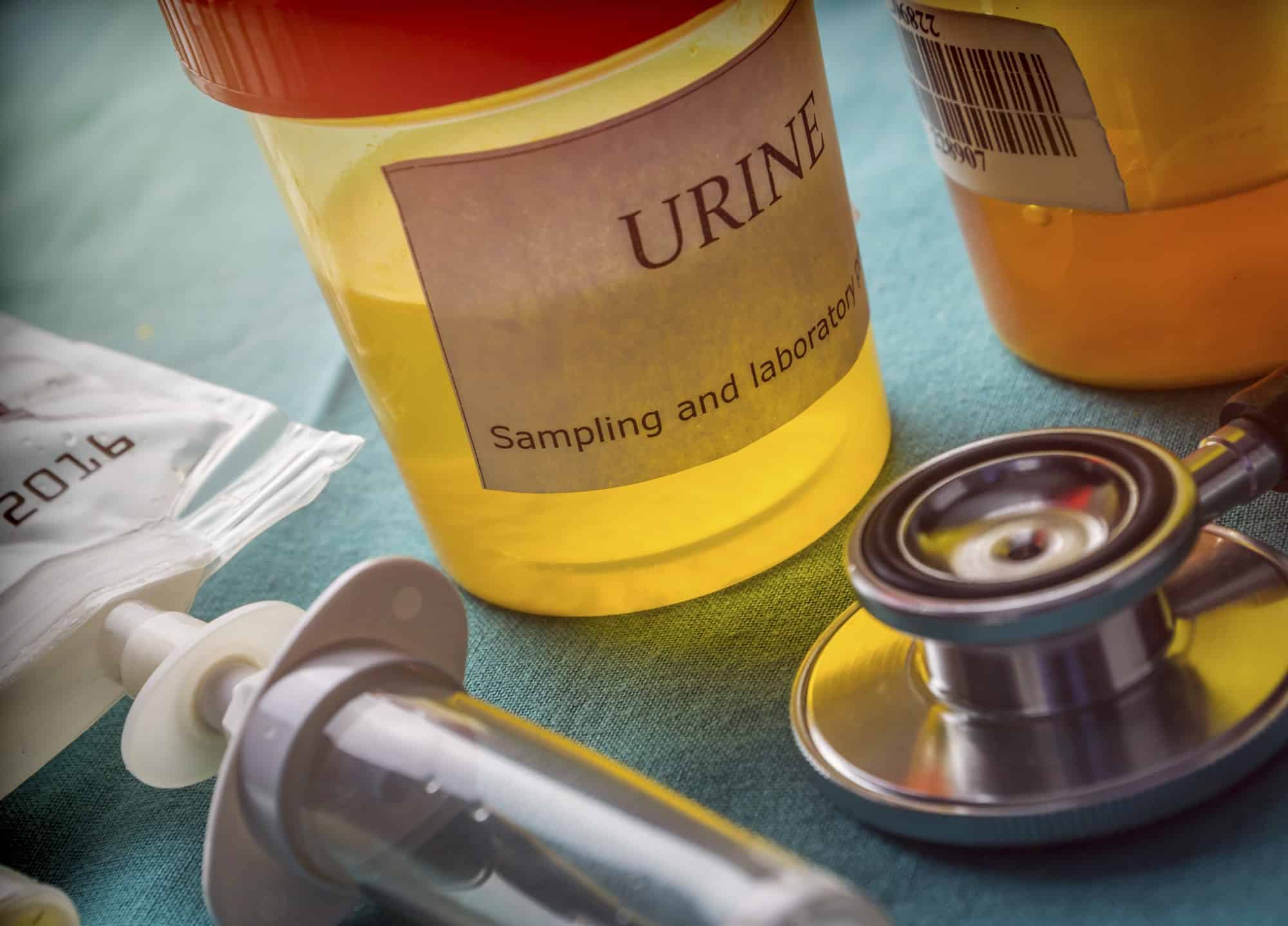 What Your Urine Color Tells About Your Health Status | ThriveNaija